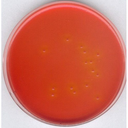 SALMONELLA SHIGELLA AGAR (SS AGAR)